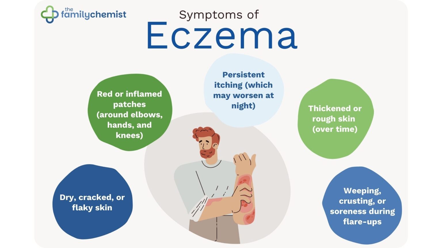Understanding Eczema: Causes & Managing Flare-Ups